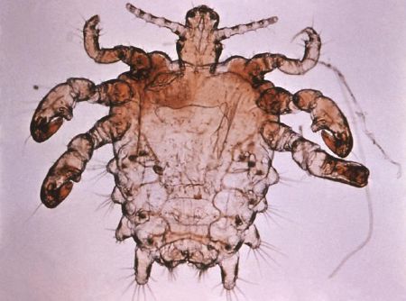 Louse - New World Encyclopedia