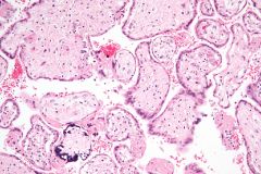 Placenta - New World Encyclopedia