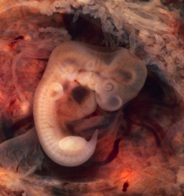 Embryo - New World Encyclopedia