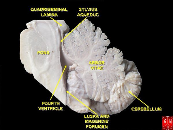 Hindbrain - New World Encyclopedia