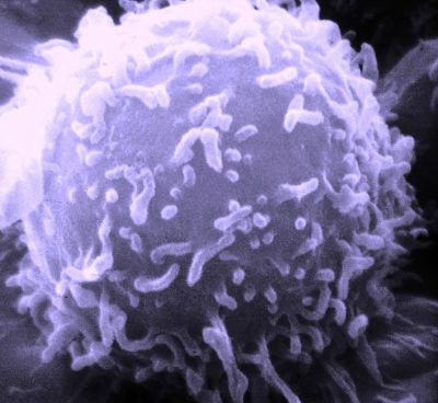 Lymphocyte - New World Encyclopedia