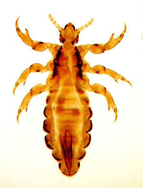 Louse - New World Encyclopedia