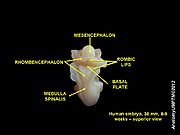 Hindbrain - New World Encyclopedia
