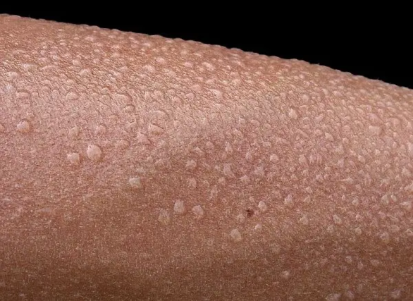Sweat - New World Encyclopedia