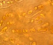 Lichen - New World Encyclopedia