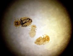 Louse - New World Encyclopedia