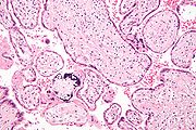 Placenta - New World Encyclopedia